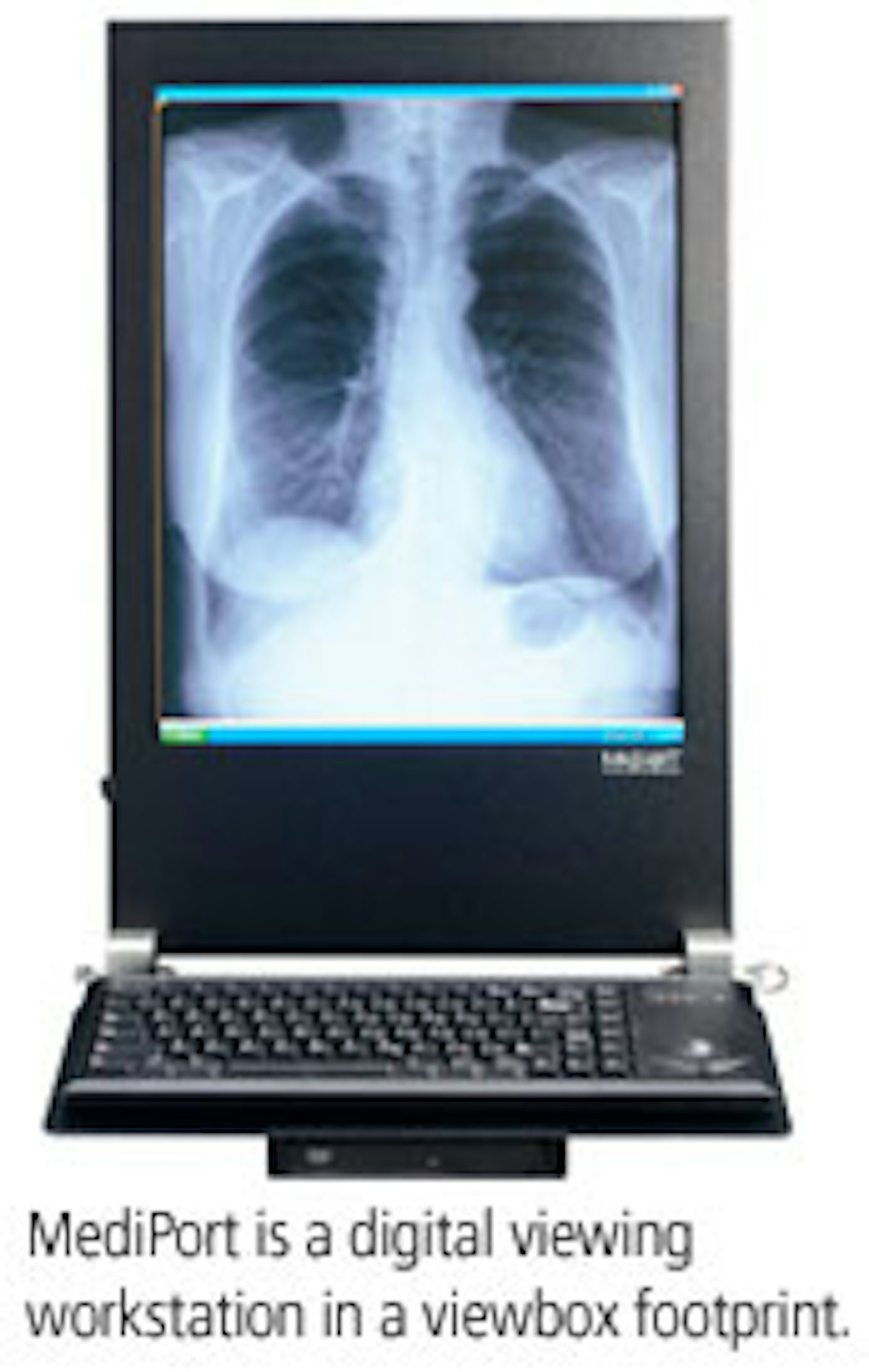 Maxant Technologies | AuntMinnie