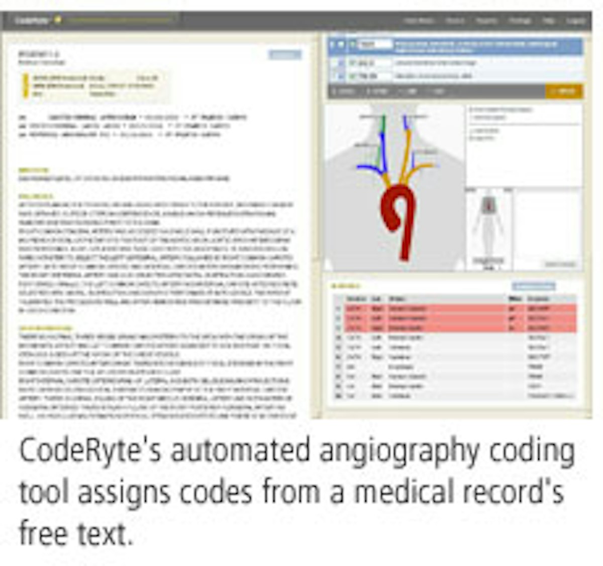 CodeRyte | AuntMinnie
