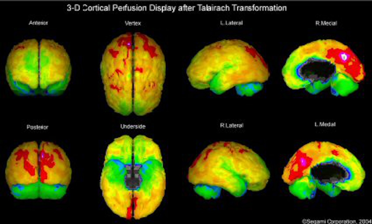 Segami highlights fusion, scheduling upgrades | AuntMinnie