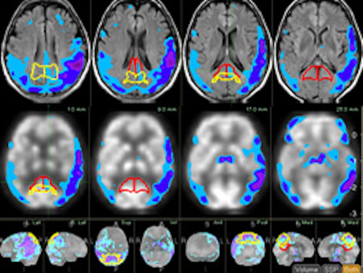 MIMVista debuts neuro software | AuntMinnie