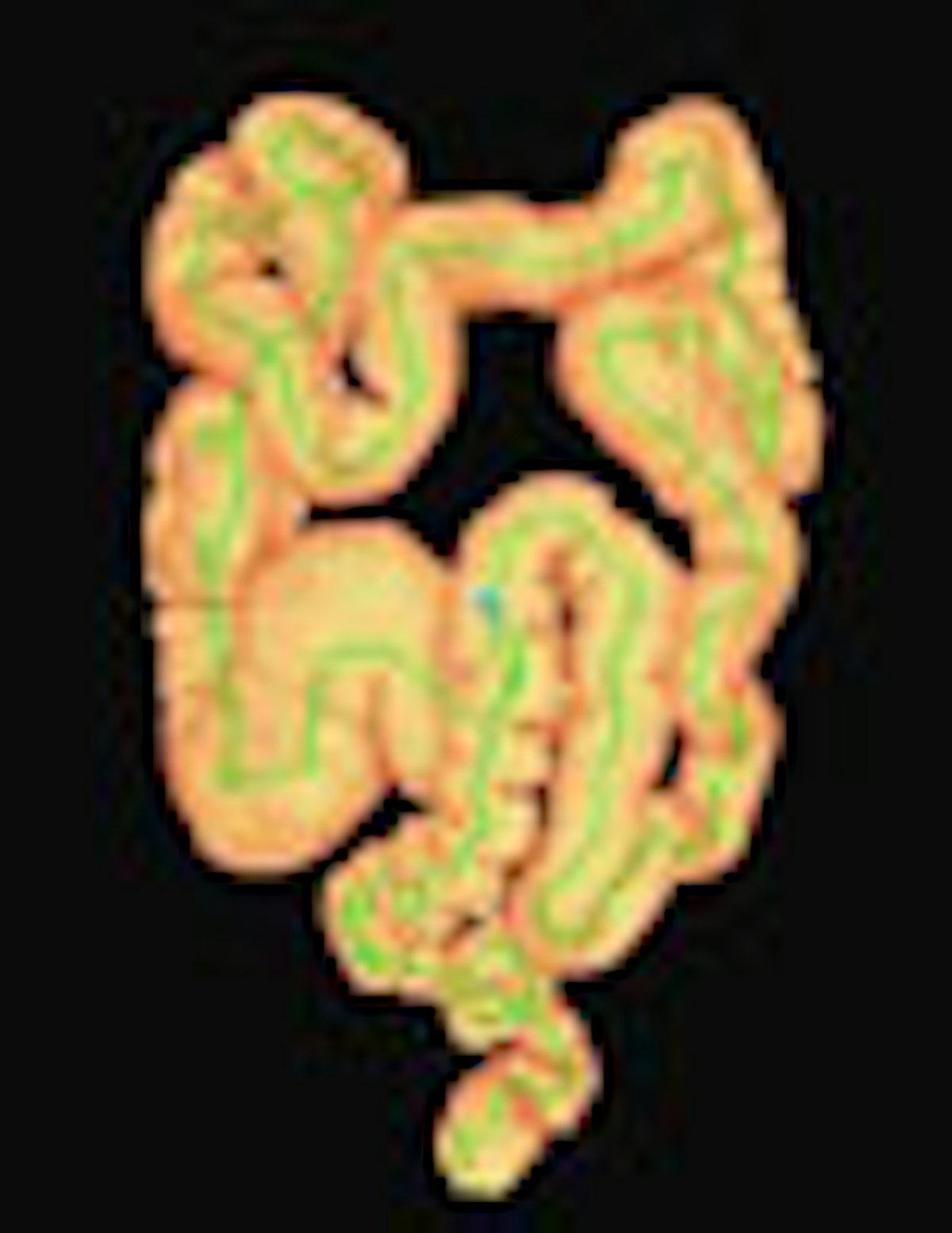 New data reveal higher efficacy for primary VC screening | AuntMinnie