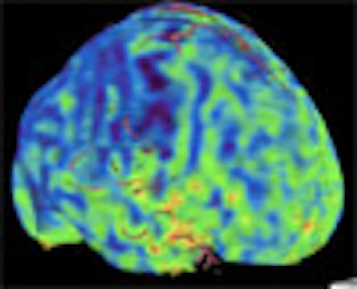 256-slice CT brings new possibilities in head imaging | AuntMinnie
