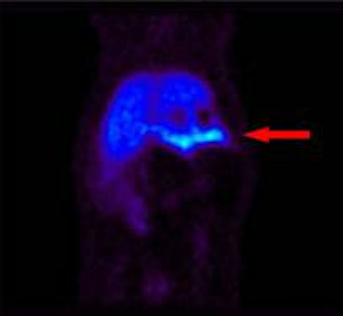 UPenn study awarded SNM Small Animal Image of the Year | AuntMinnie