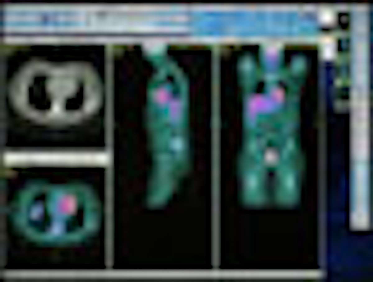 Intuitive Imaging Informatics | AuntMinnie