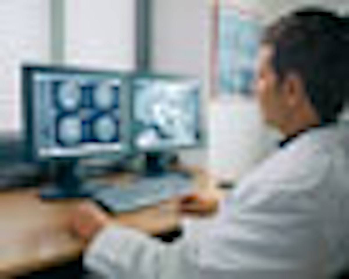 Visus Technology Transfer | AuntMinnie