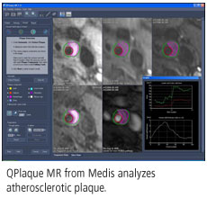 Medis medical imaging systems | AuntMinnie
