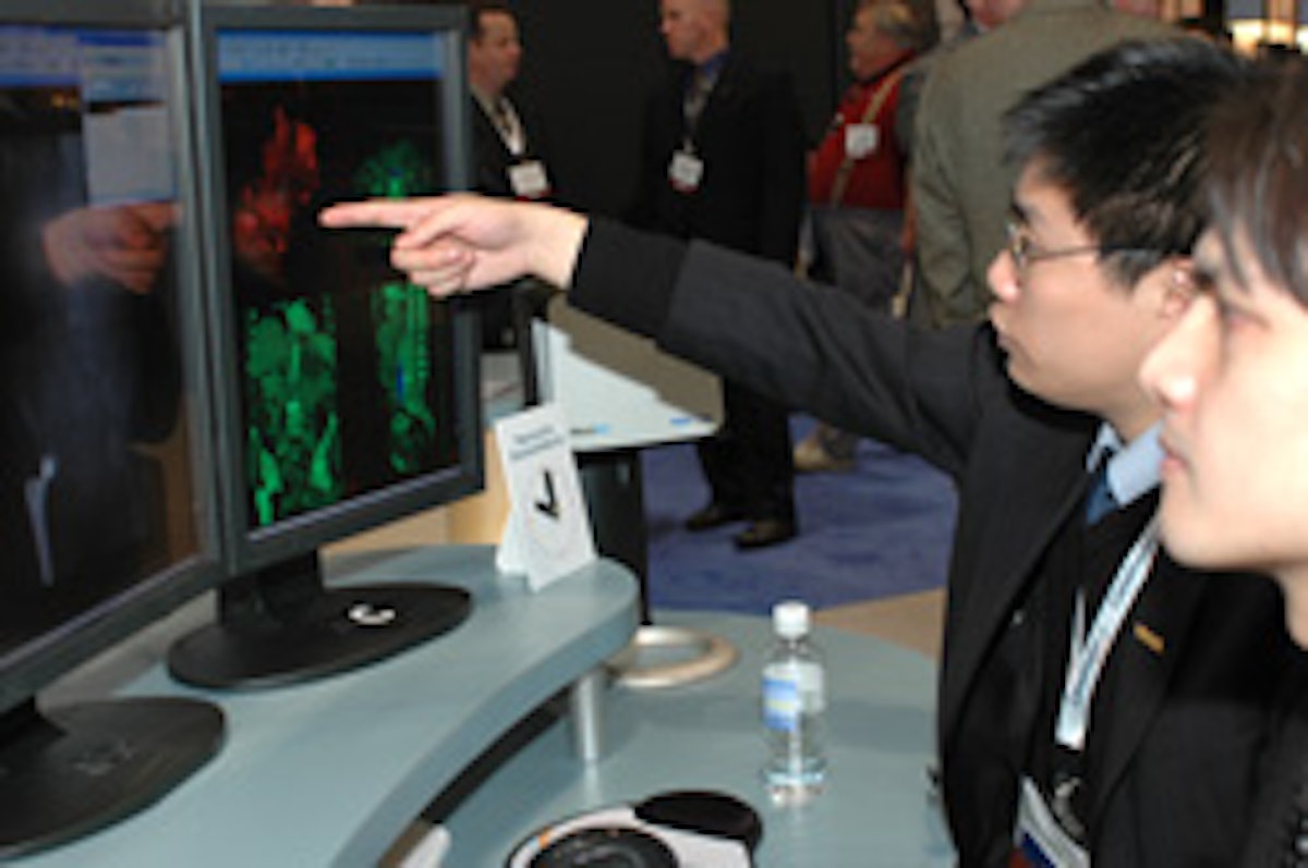 Carestream highlights CR readers, RIS/CAD, mammo CAD | AuntMinnie