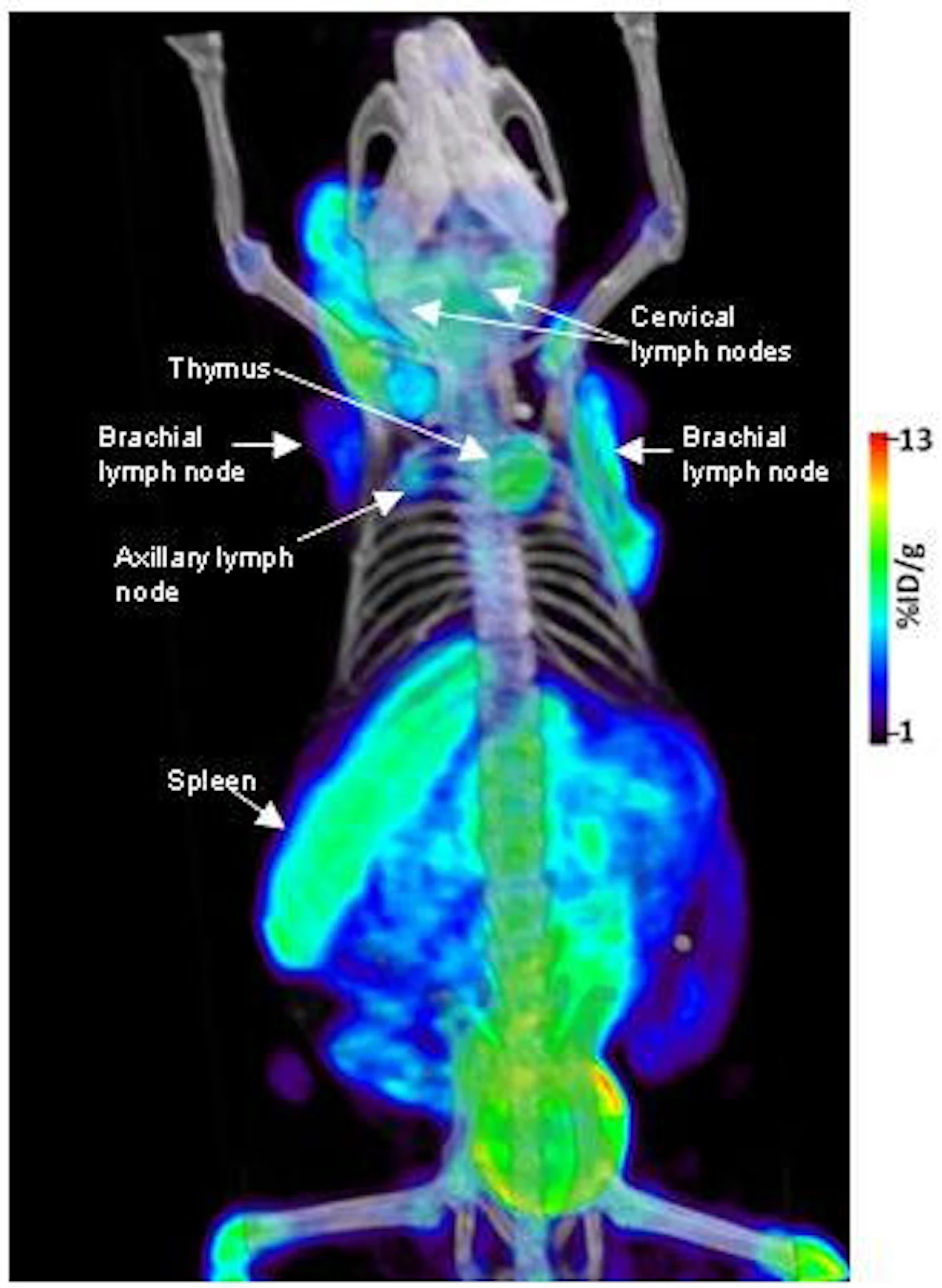 UCLA develops new PET probe to monitor immune system | AuntMinnie