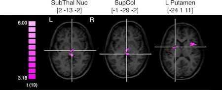 Functional MRI scans clues to best multitasking times | AuntMinnie