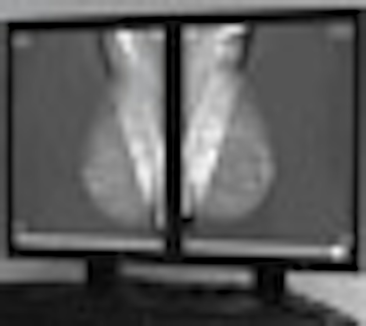 Three Palm Software | AuntMinnie