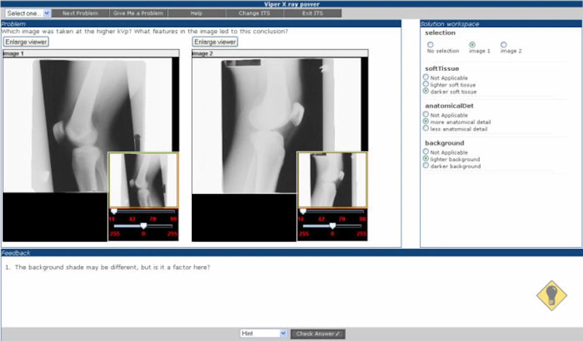 VIPER: Effective training for medical imaging | AuntMinnie