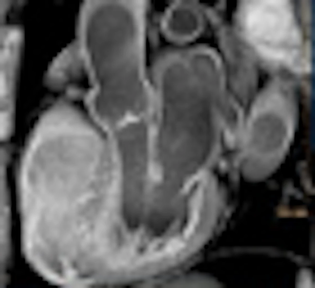 Wide-area CT detectors boost some clinical applications | AuntMinnie