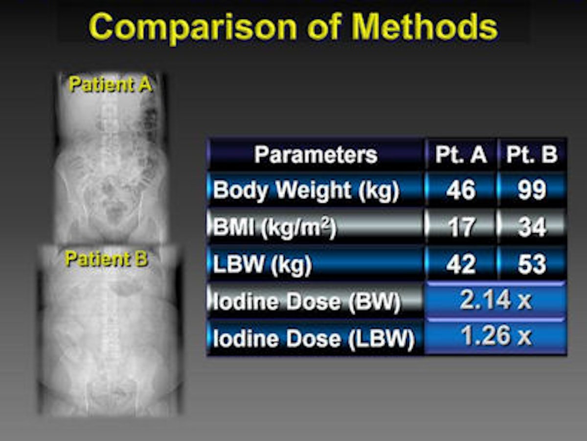Measuring lean body weight can optimize CT contrast dose | AuntMinnie