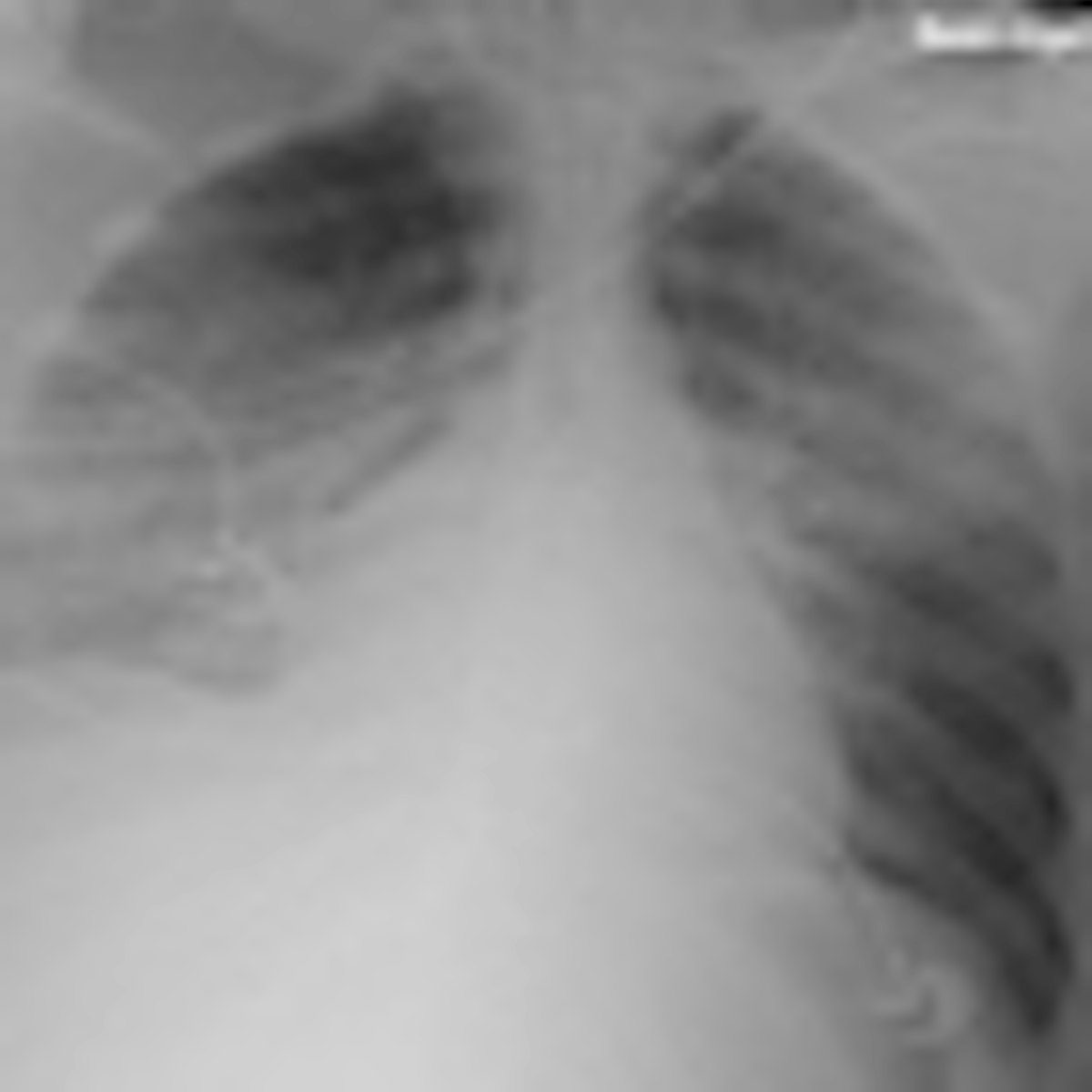 Study questions daily chest x-rays for intensive care patients | AuntMinnie