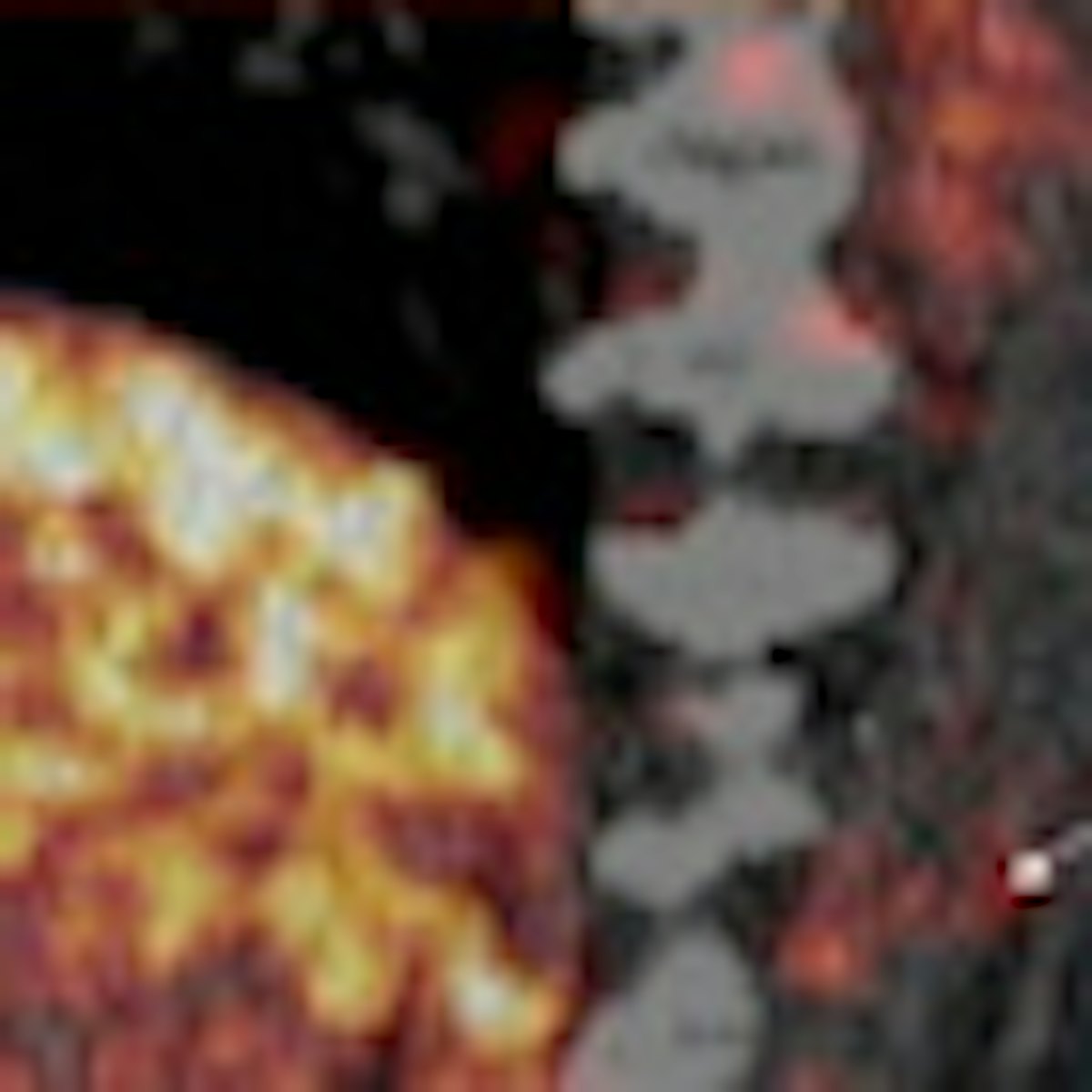 FDG-PET/CT viability scans detect vulnerable aortic plaque | AuntMinnie