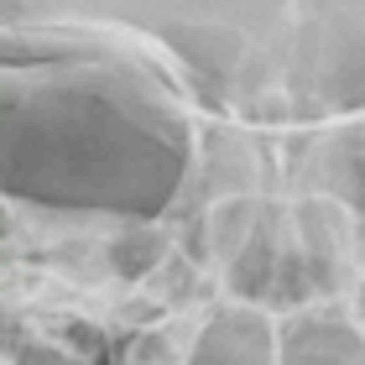 Swissray founder launches new digital x-ray software venture | AuntMinnie