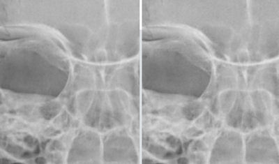 Swissray founder launches new digital x-ray software venture | AuntMinnie