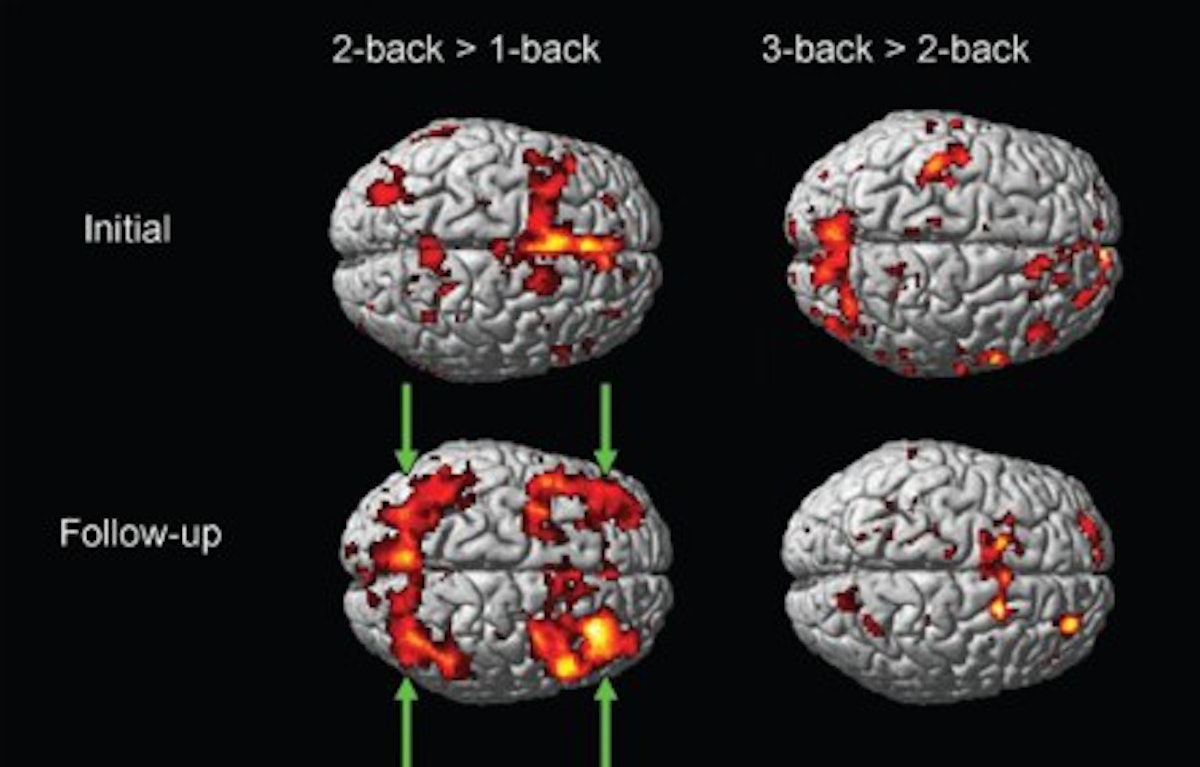 fmri scans