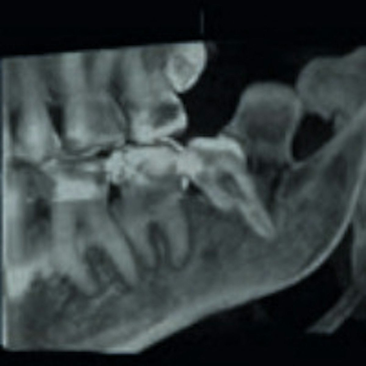 Teeth: The feature radiologists need to know more about | AuntMinnie