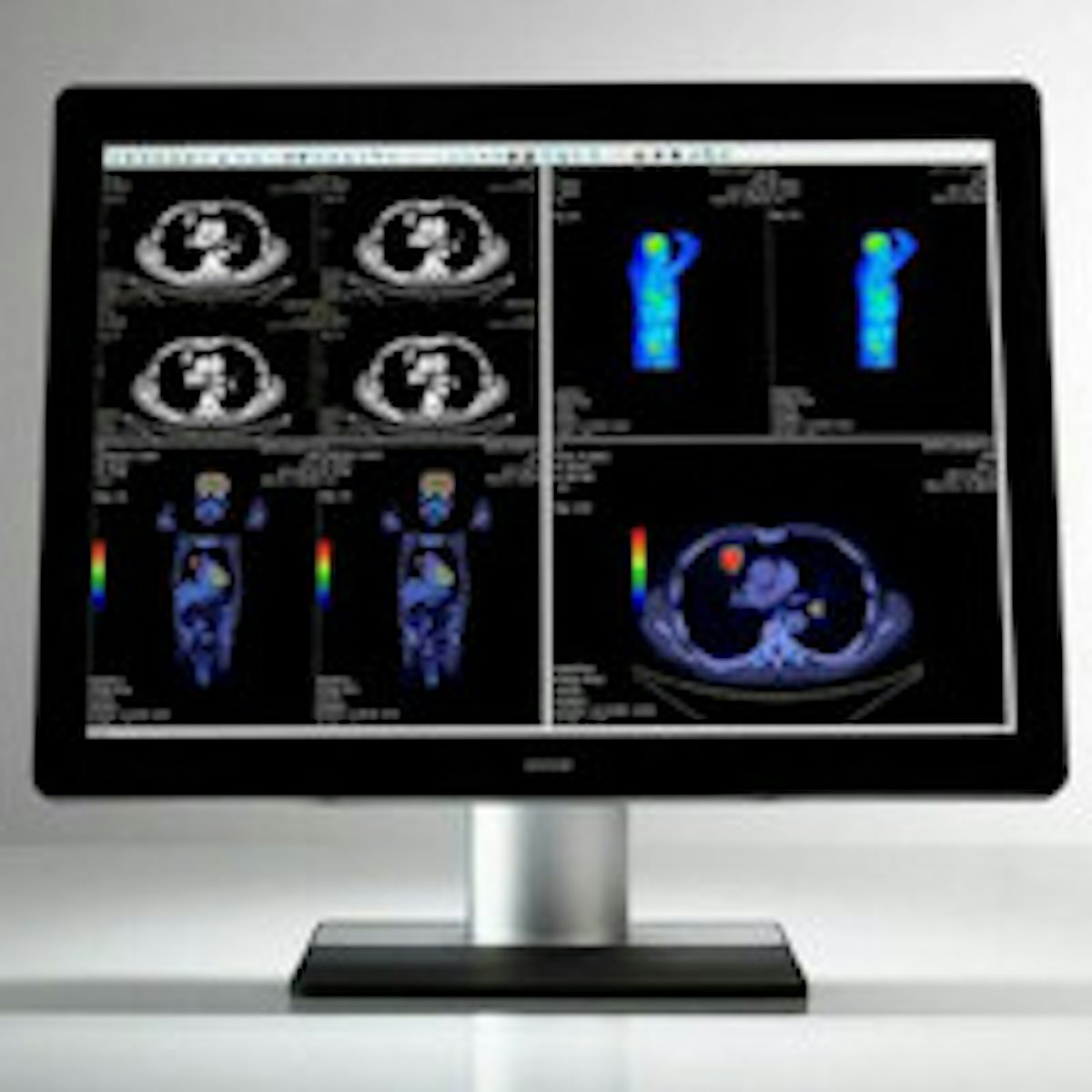 Barco unites medical displays with Uniti launch at JFR | AuntMinnie