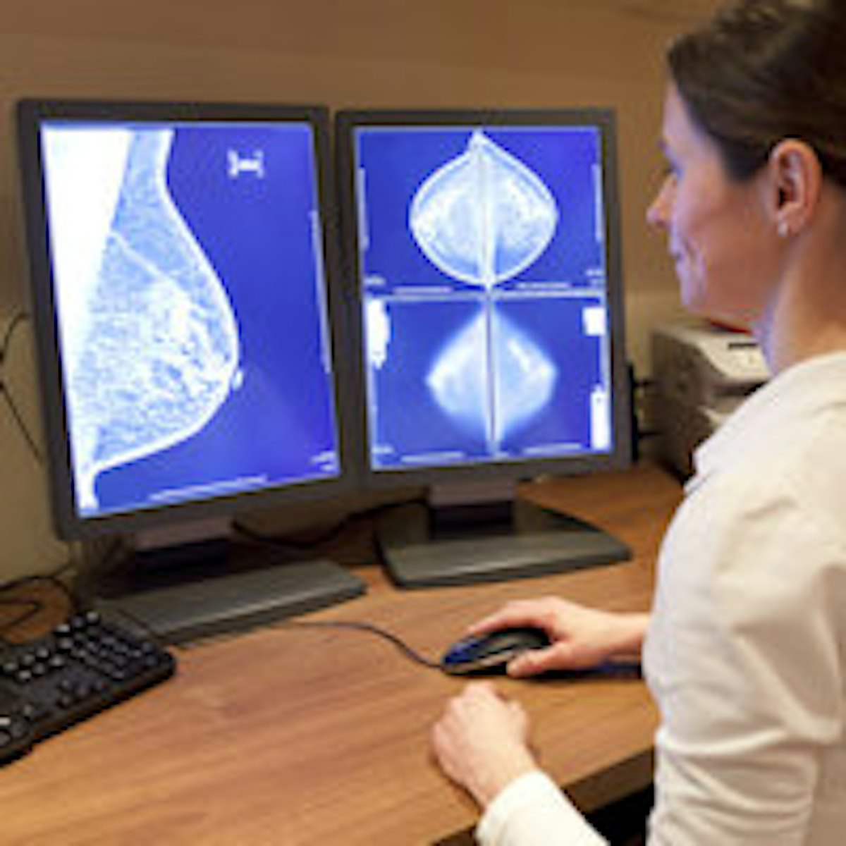 Mammography database makes performance tracking easier | AuntMinnie