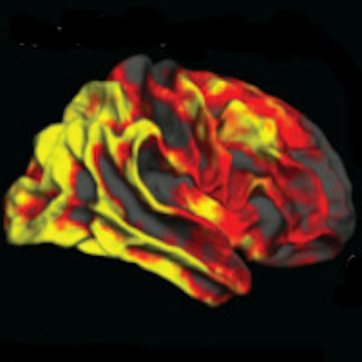 Novel PET combination awarded SNMMI Image of the Year | AuntMinnie