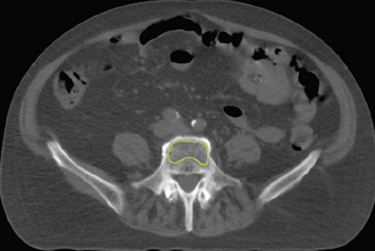 ct venogram pelvis cpt code