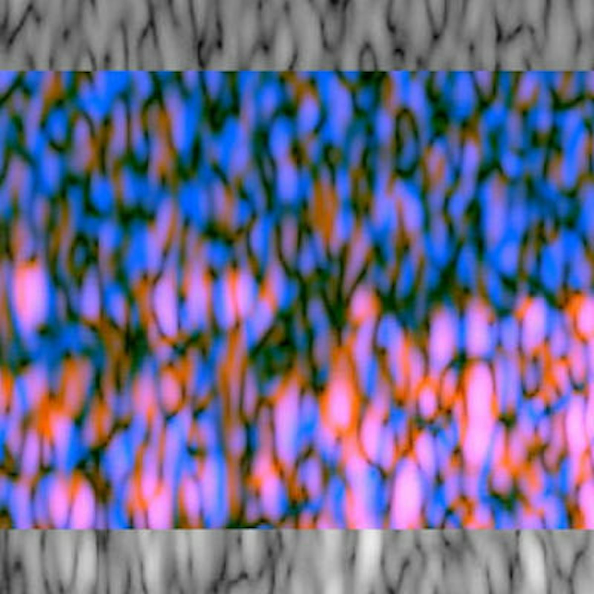 Math functions add color, detail to ultrasound images | AuntMinnie