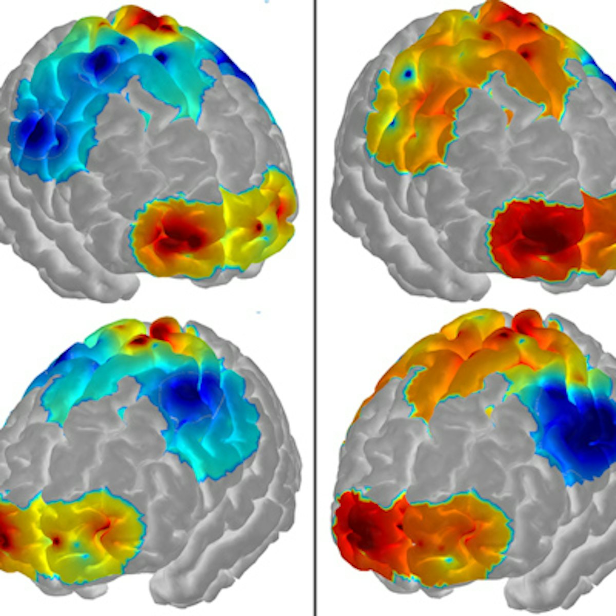 Virtual surgery simulation boosts brain activity on fNIRS | AuntMinnie