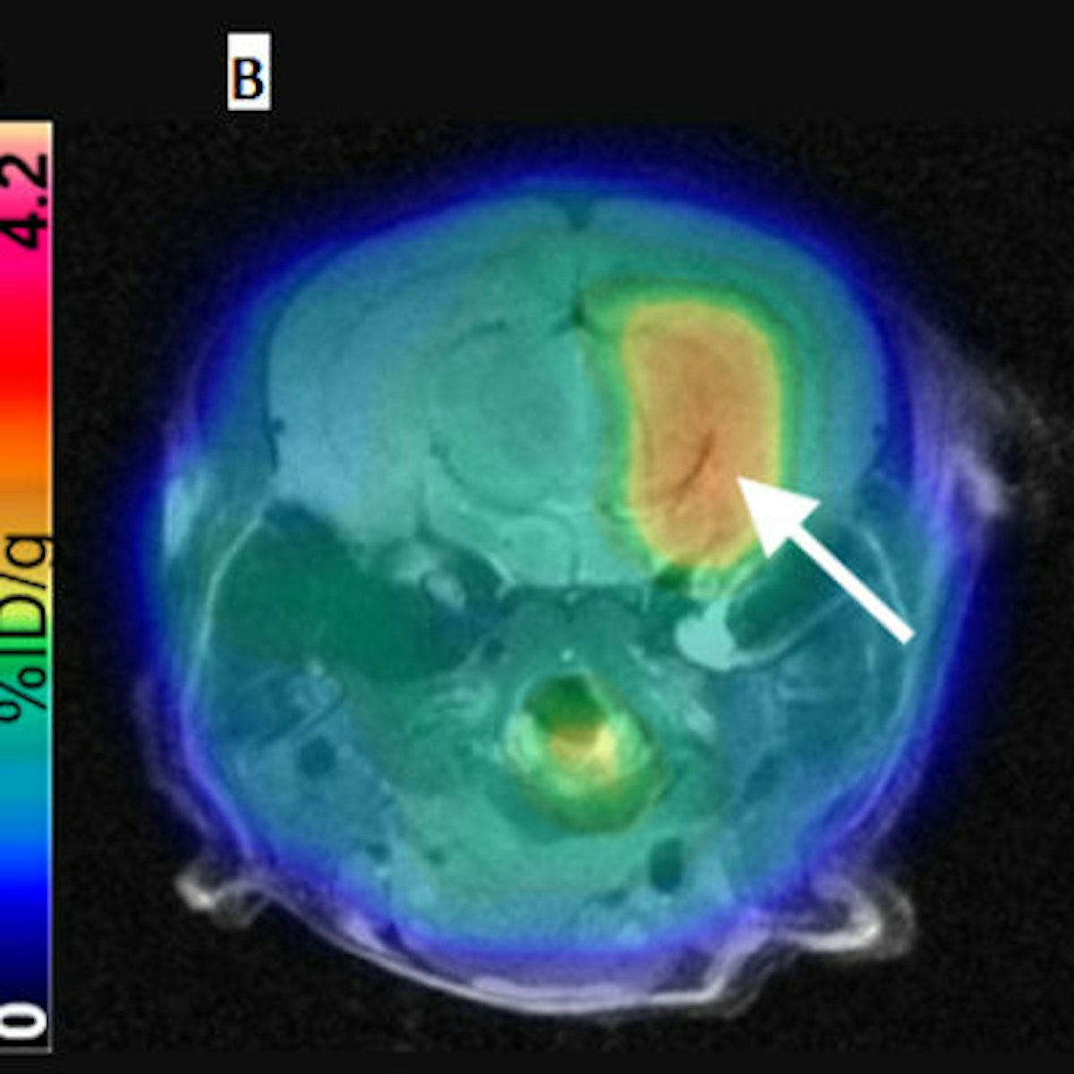 SNMMI: Molecular imaging method monitors gene therapy | AuntMinnie