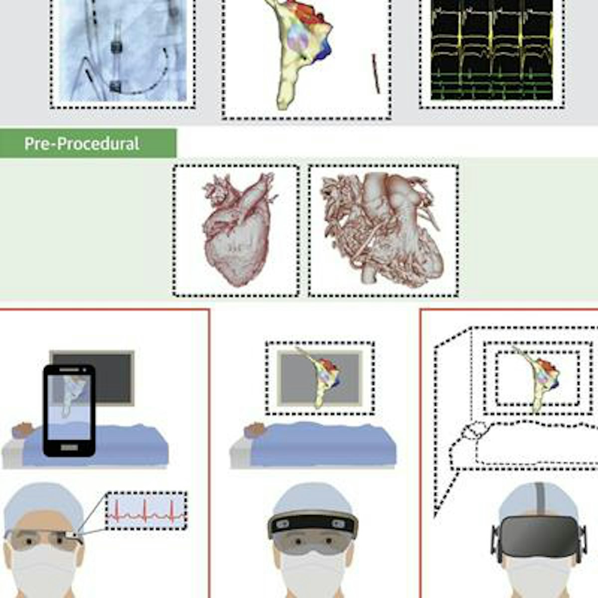 VR, AR may revamp cardiovascular imaging | AuntMinnie
