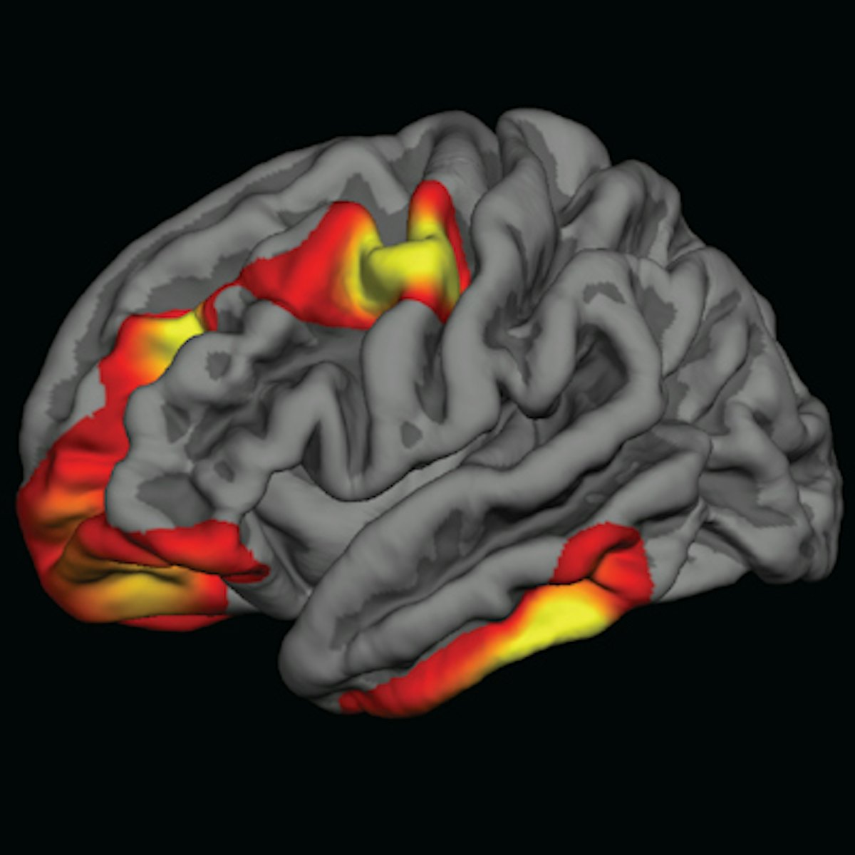 MRI brain scans show benefits of prenatal folic acid | AuntMinnie