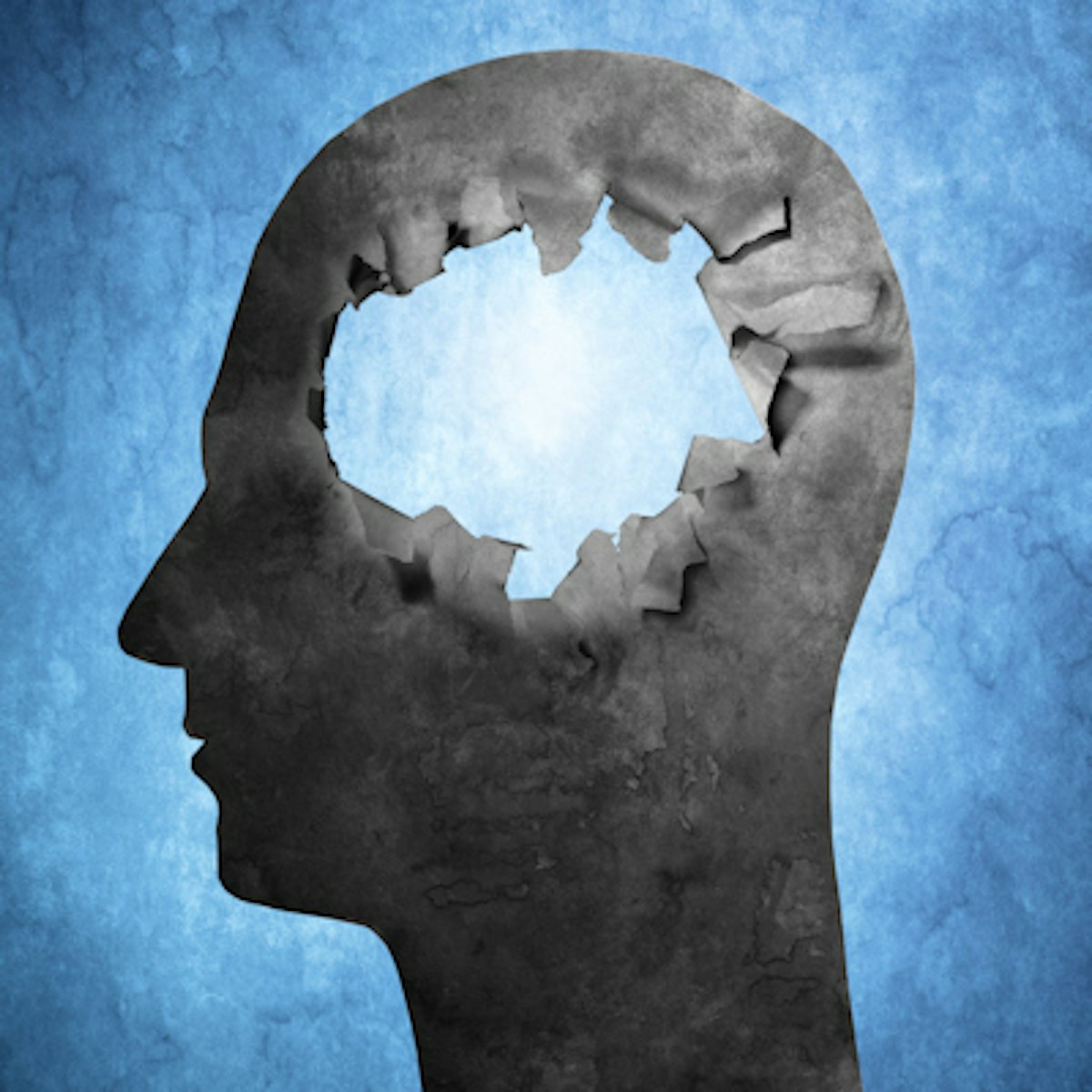 MRI shows link between radiation and memory loss in kids | AuntMinnie