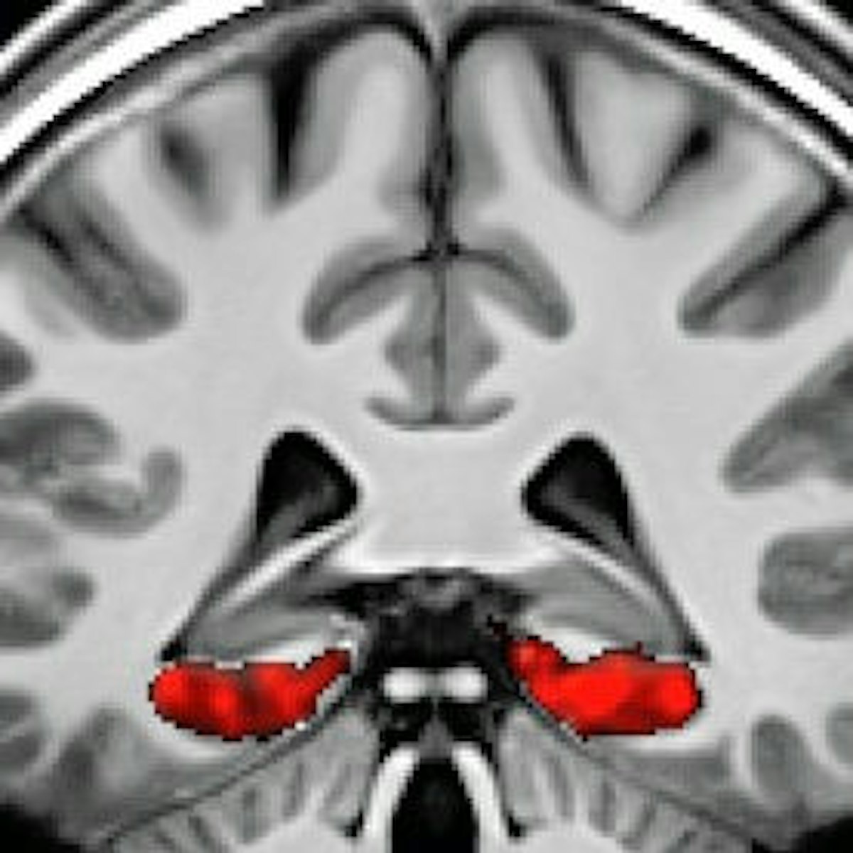 7T fMRI, AI illustrate how memories help with daily activities | AuntMinnie