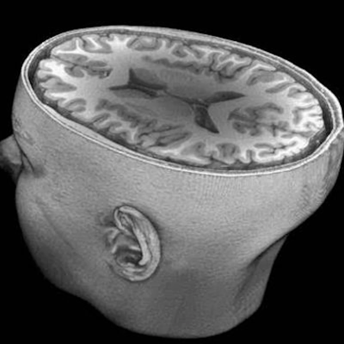 Can 7-tesla MRI make the transition to clinical prime time? | AuntMinnie