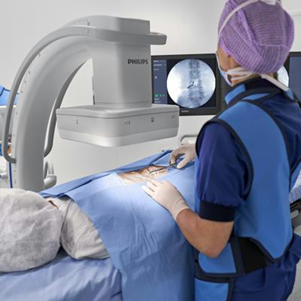 Philips launches new Zenition mobile C-arm | AuntMinnie