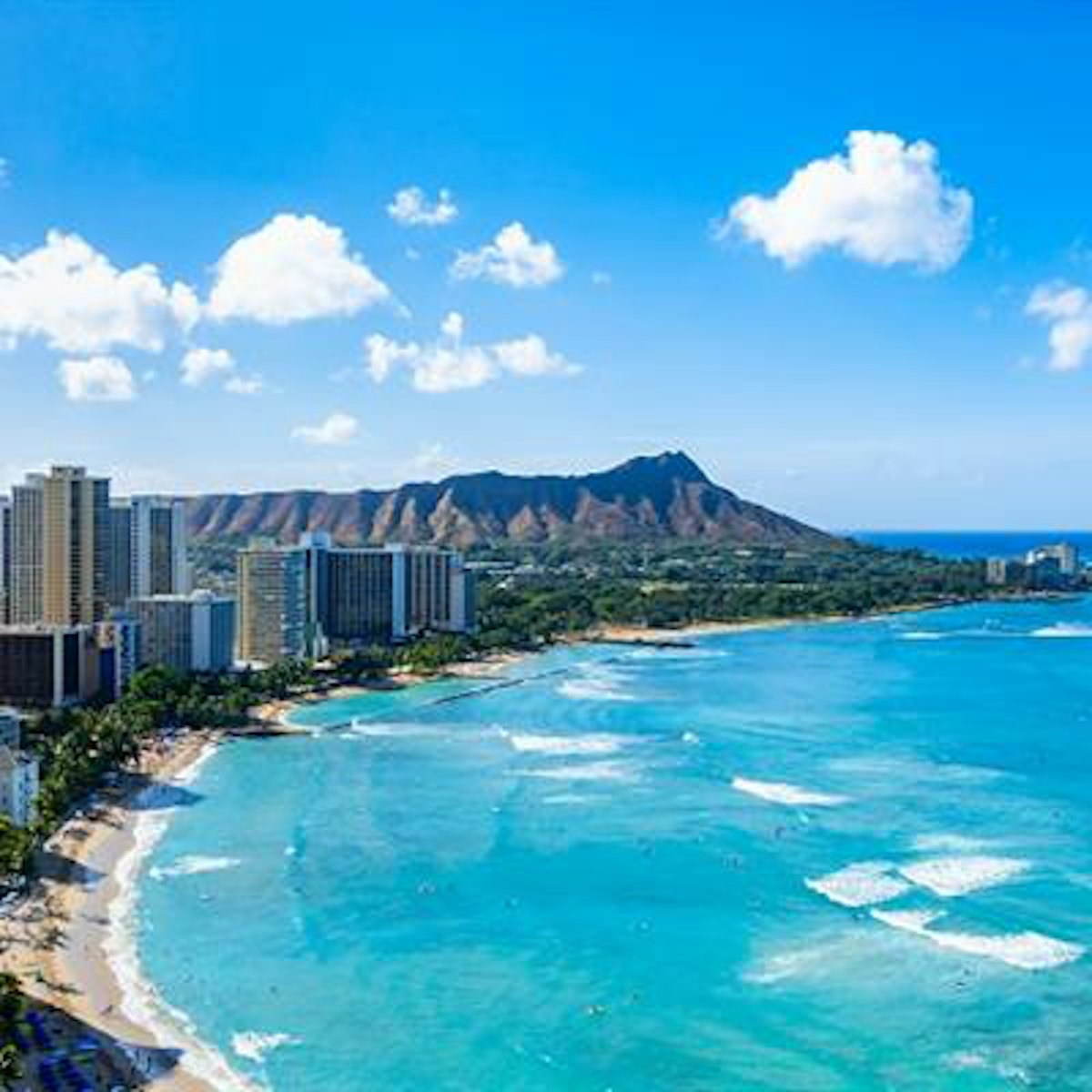 ARRS: MRI technique shows promise for skull fractures | AuntMinnie