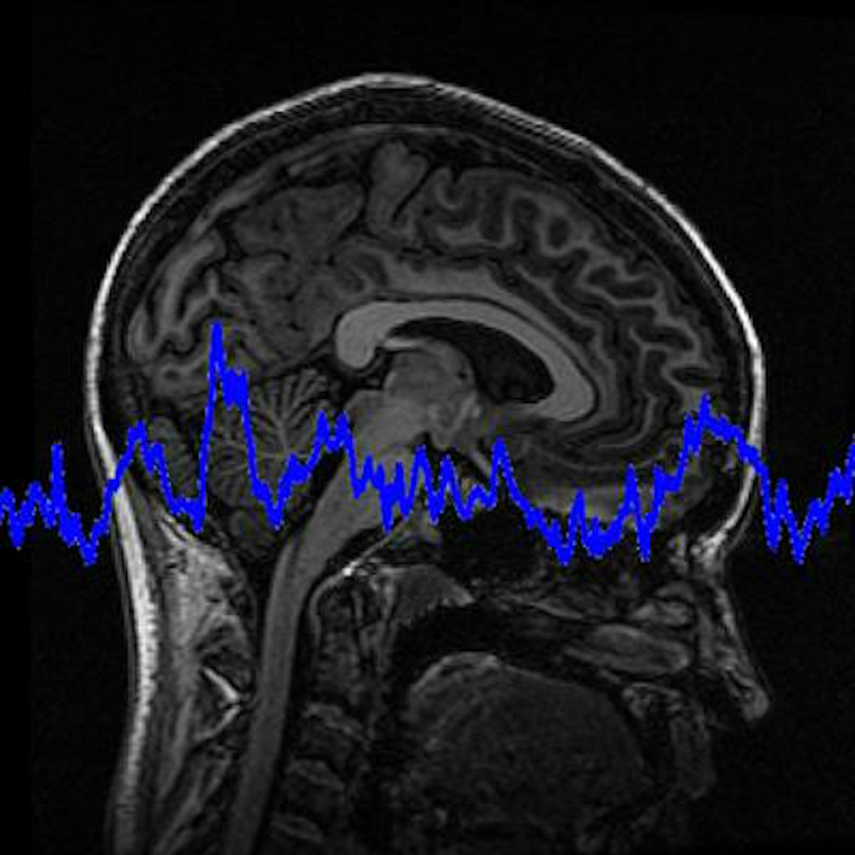 MRI shows adverse effects of U.S. embassy mystery | AuntMinnie