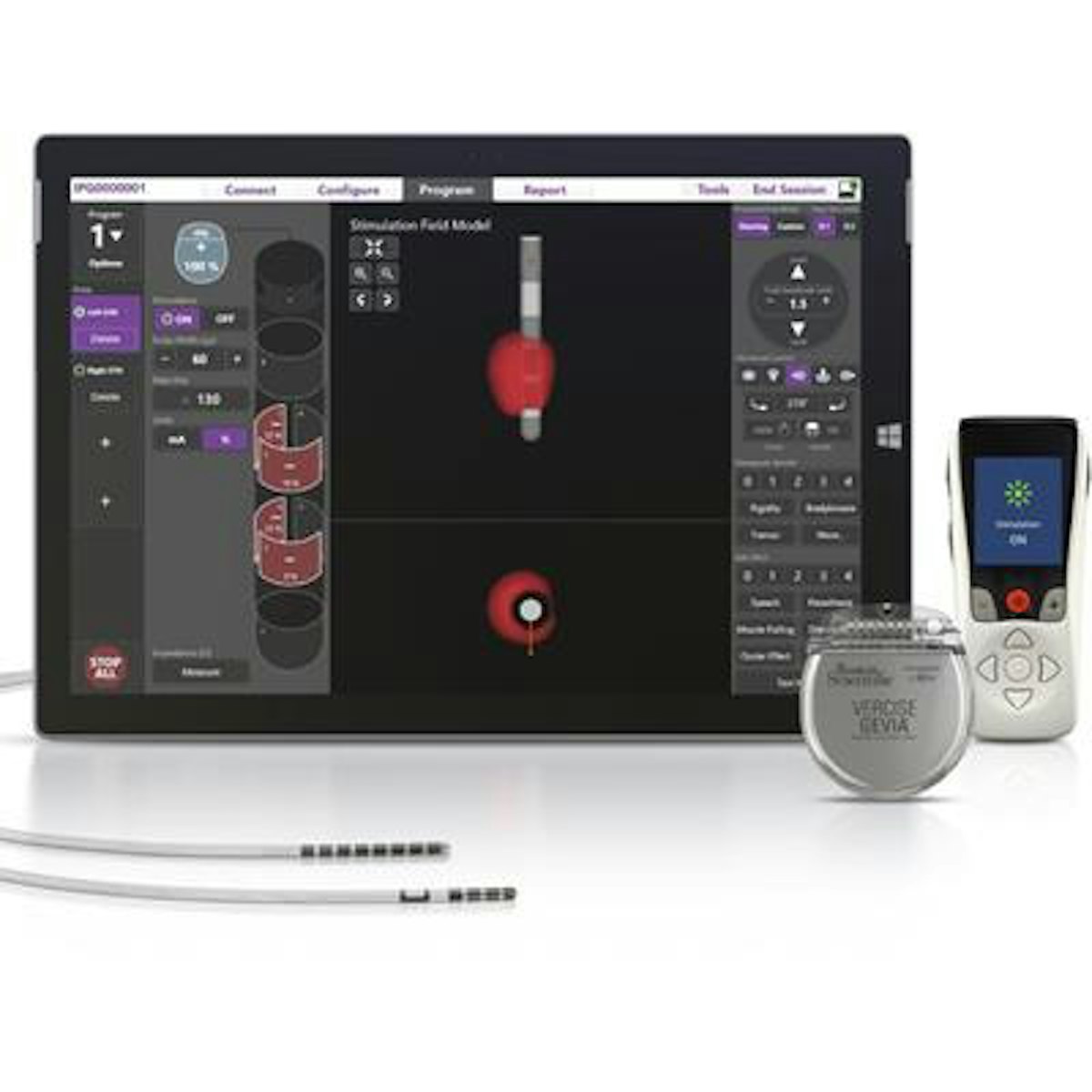 FDA OKs Boston Scientific's MRI-conditional DBS device | AuntMinnie