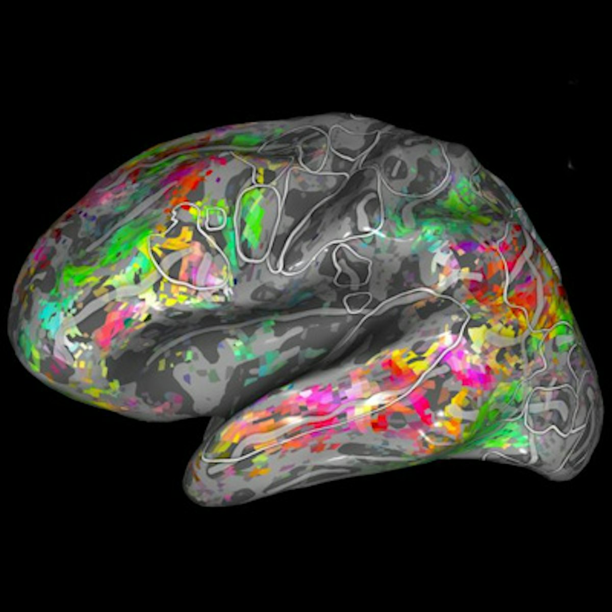 fMRI connects words to brain activity | AuntMinnie