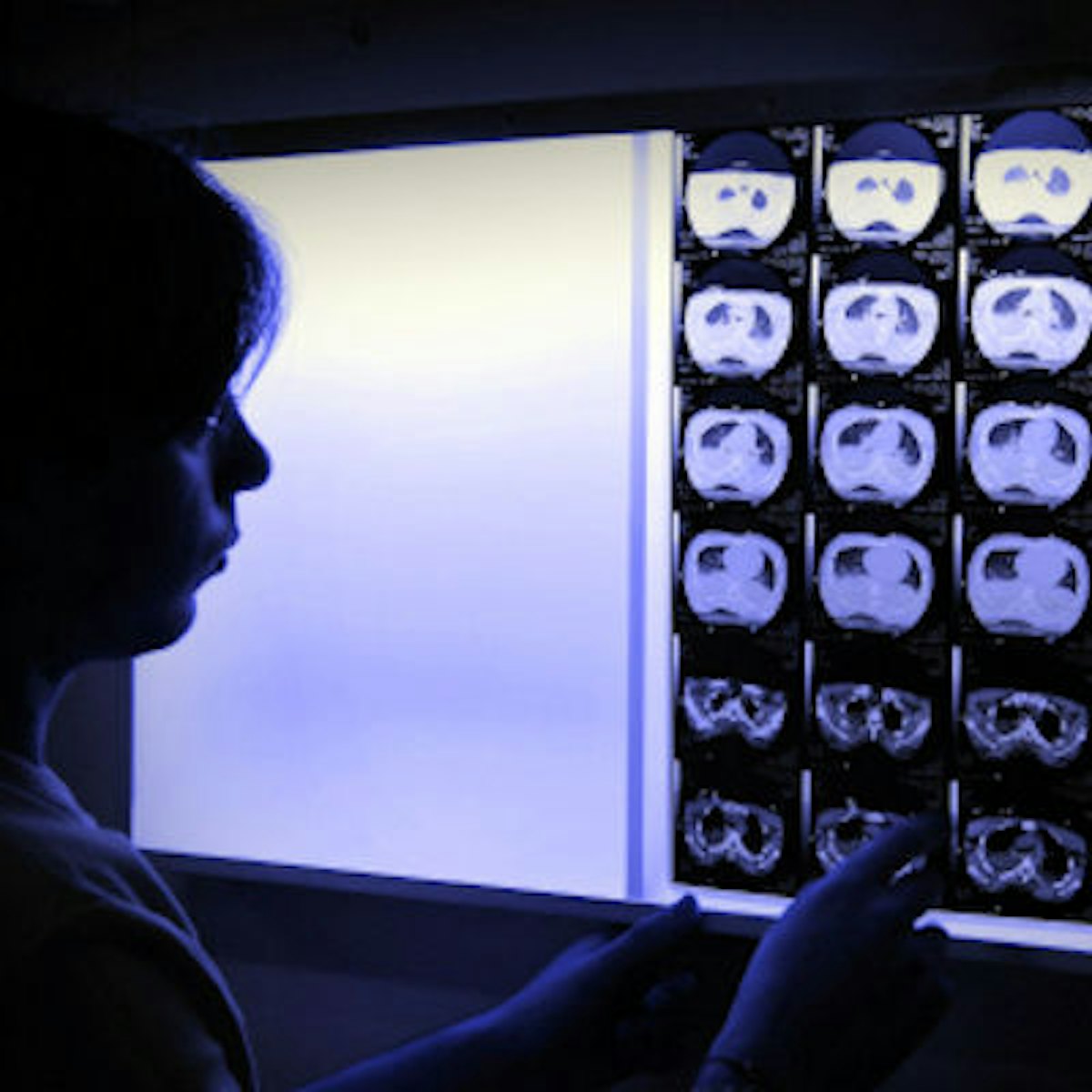 Intelerad launches reading workflow software | AuntMinnie