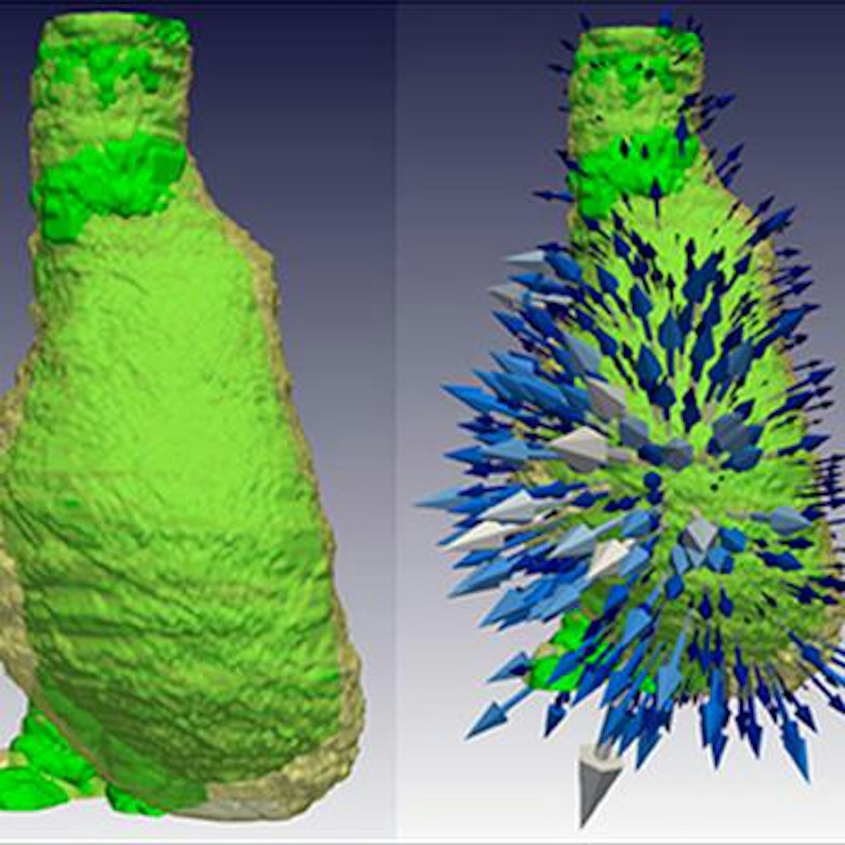 New method estimates postsurgical AAA rupture risk on CTA | AuntMinnie