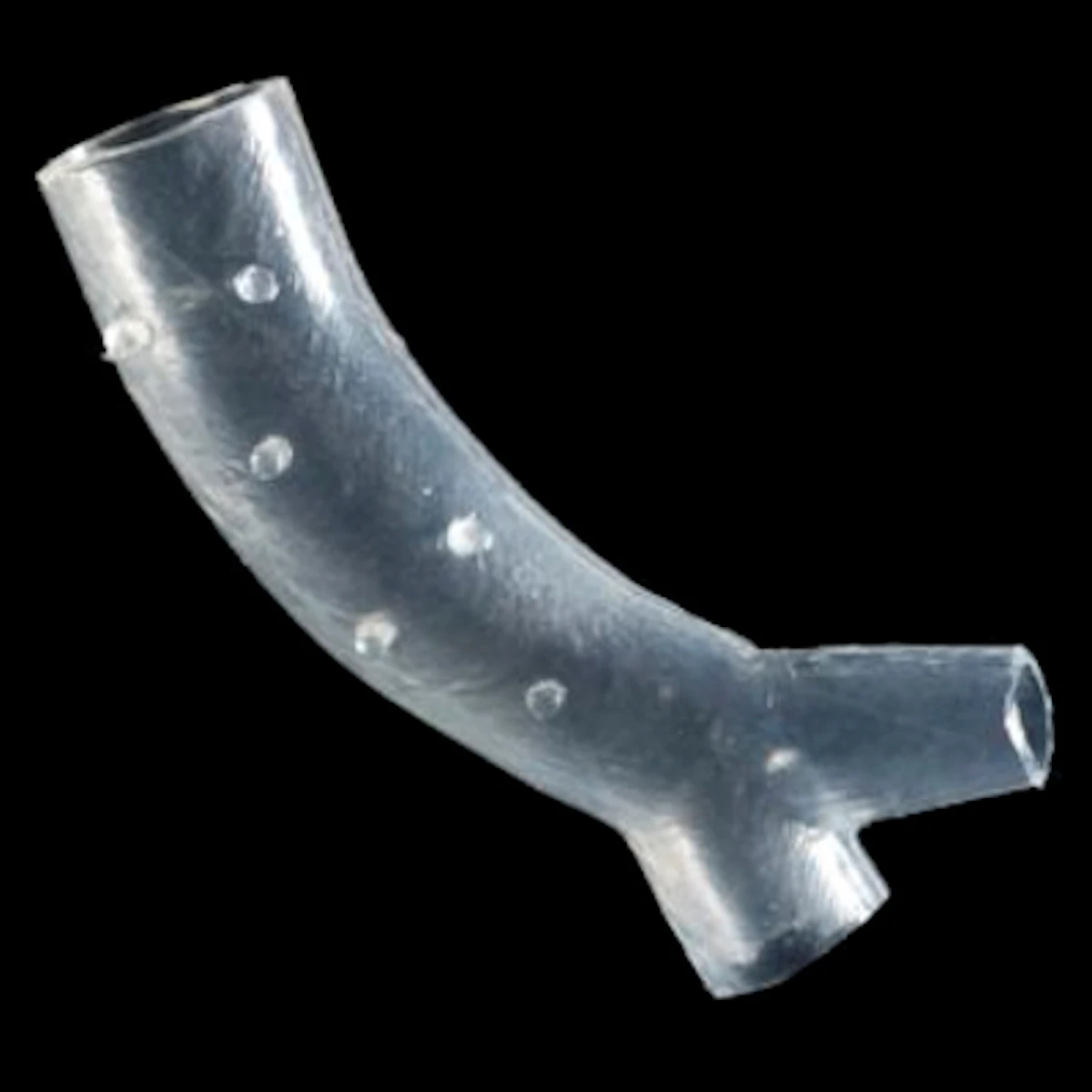 FDA clears patient-specific 3D-printed airway stent | AuntMinnie