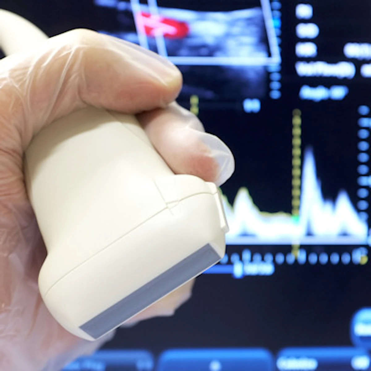 Philips, ESR partner on ultrasound program at ECR 2020 | AuntMinnie