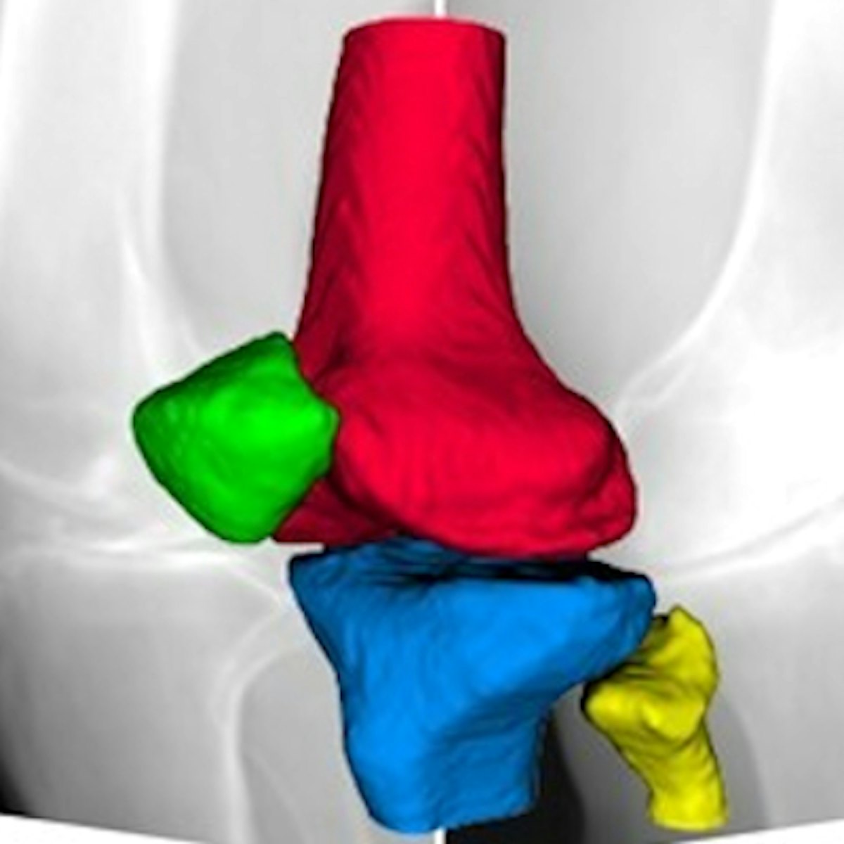 RSIP Vision develops AI module for 3D knee x-ray | AuntMinnie