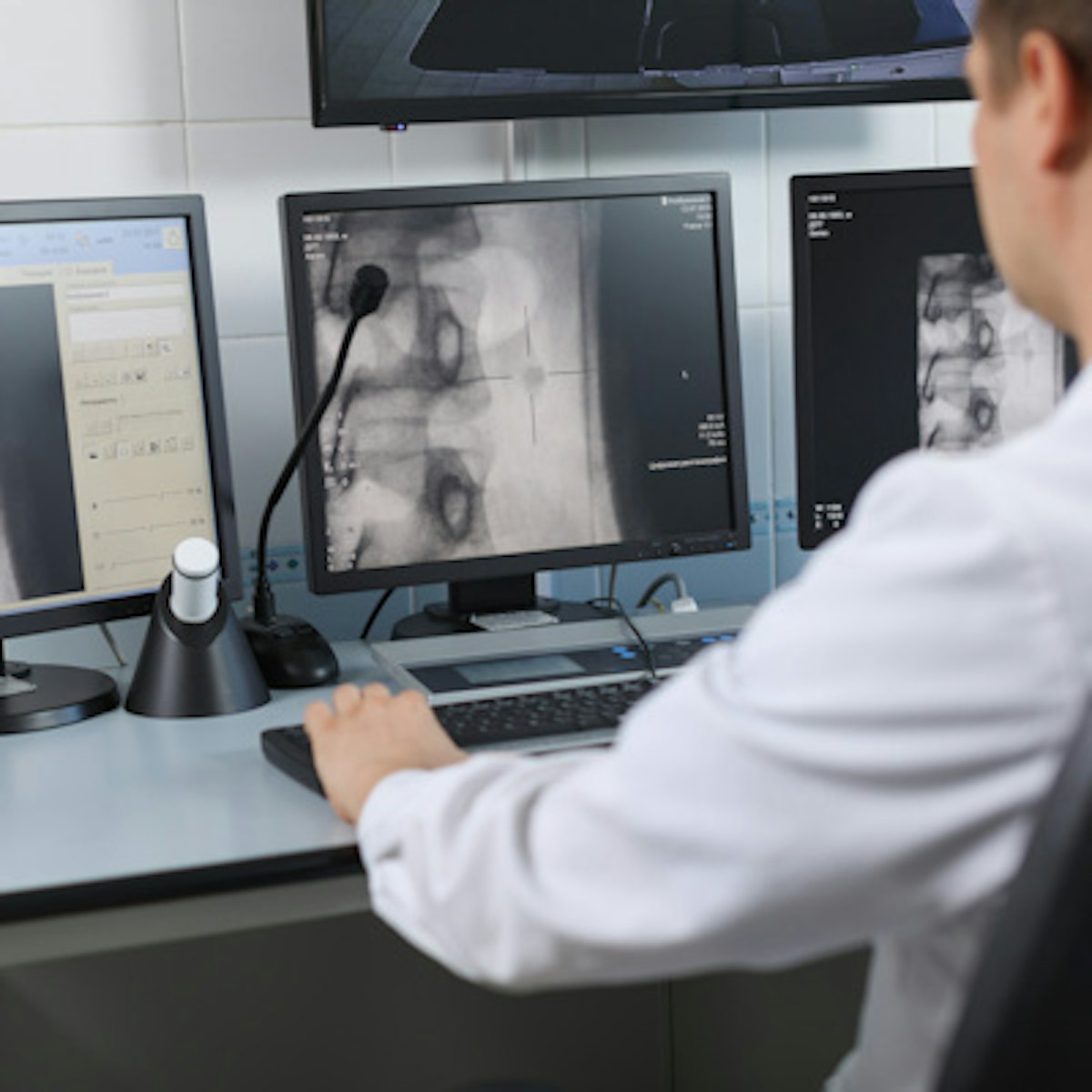 Barco releases new medical display controllers | AuntMinnie