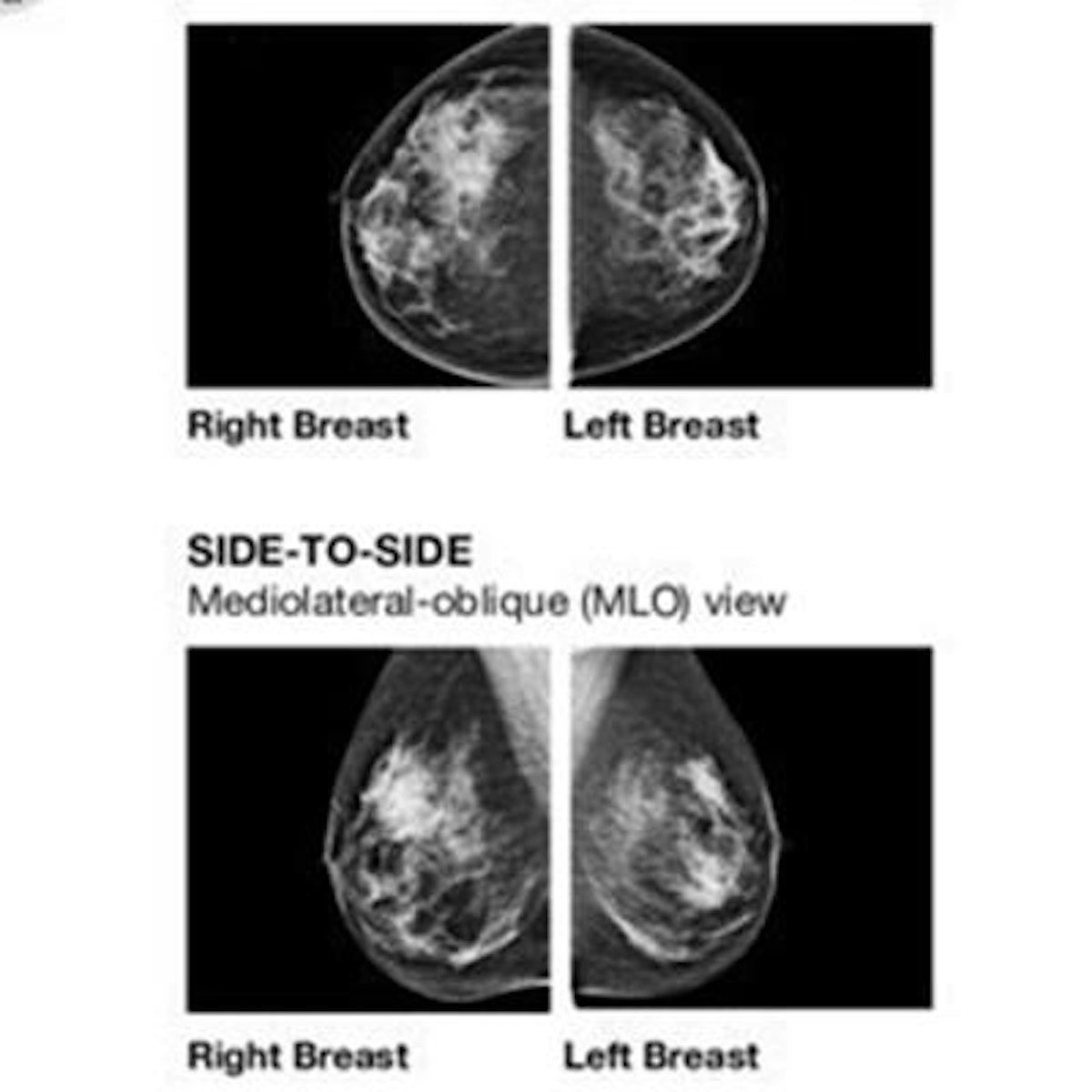 Volpara tool lets docs add images to density letters | AuntMinnie