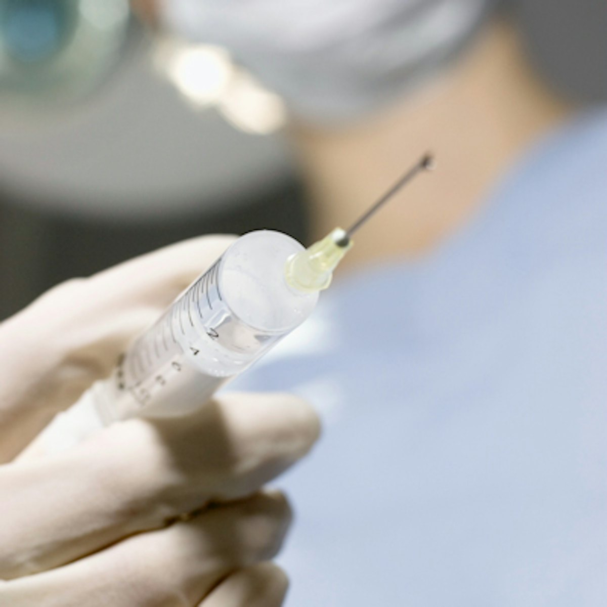 DTI-MRI shows effects of anesthesia on brain's white matter | AuntMinnie