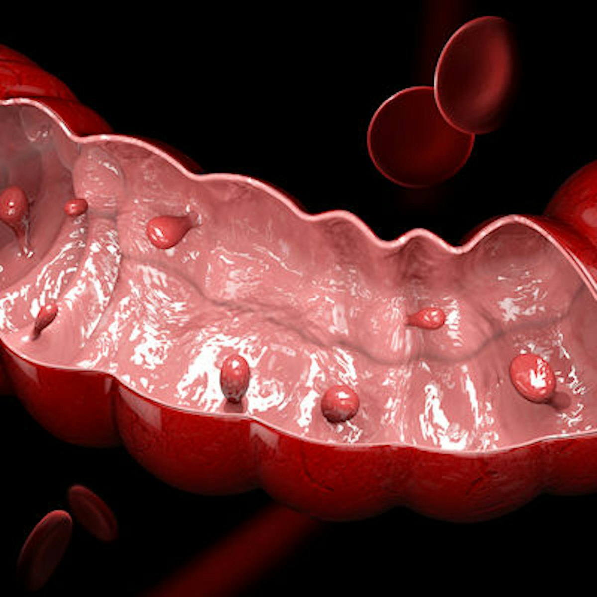 USPSTF lowers starting age for colon cancer screening | AuntMinnie