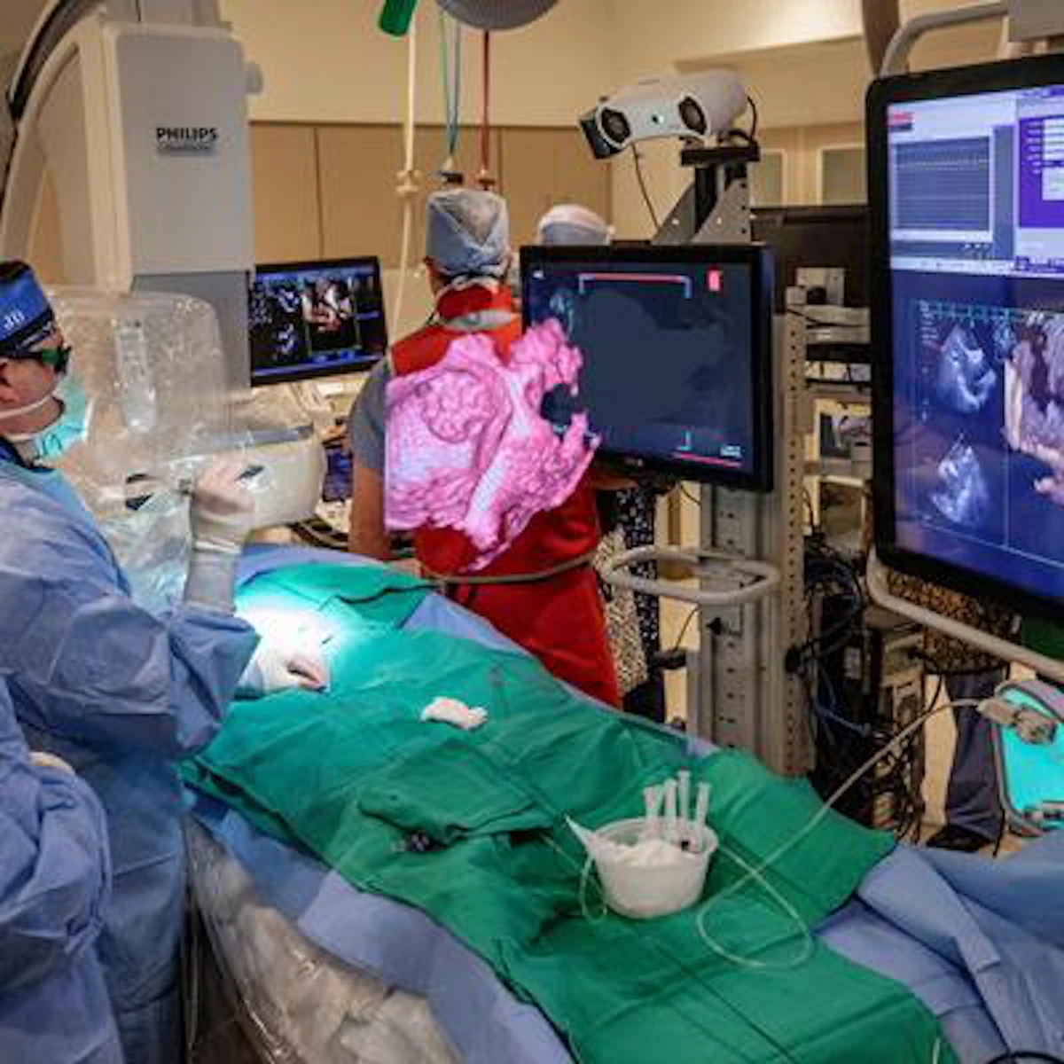 1st heart procedure using EchoPixel's HTG tool completed | AuntMinnie